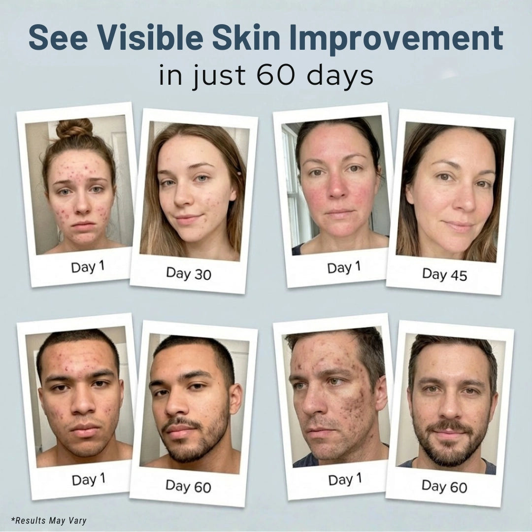 ClearFace™ - Acne & Redness Relief Balm – Rectivi